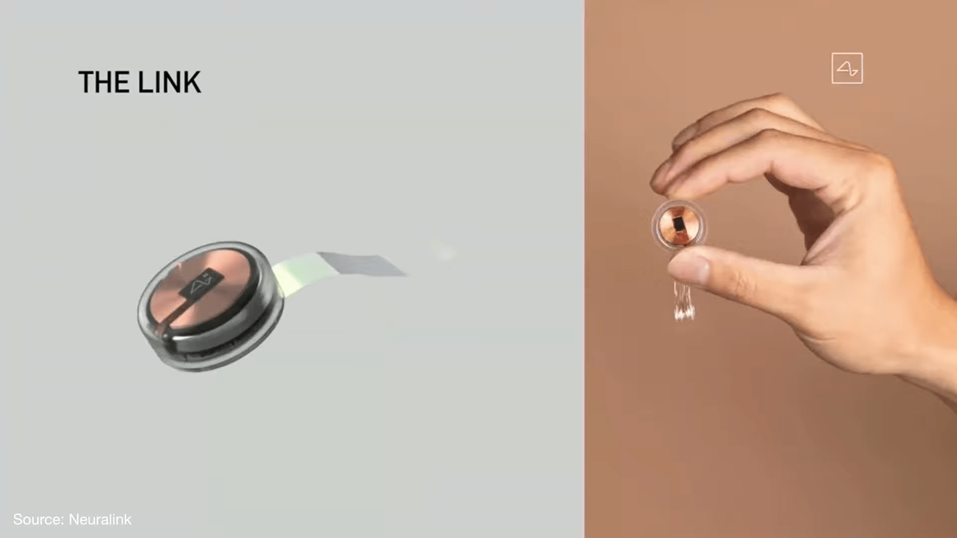 Neuralink : comment marche cet implant pour le cerveau